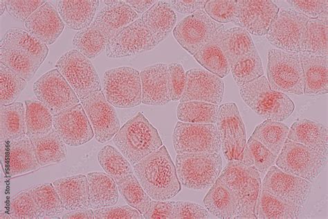 Root Tip Of Onion And Mitosis Cell In The Root Tip Of Onion Under A Microscope Stock Photo