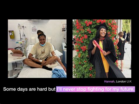 This Is What Sickle Cell Disease Looks Like Burden Of Illness And Its