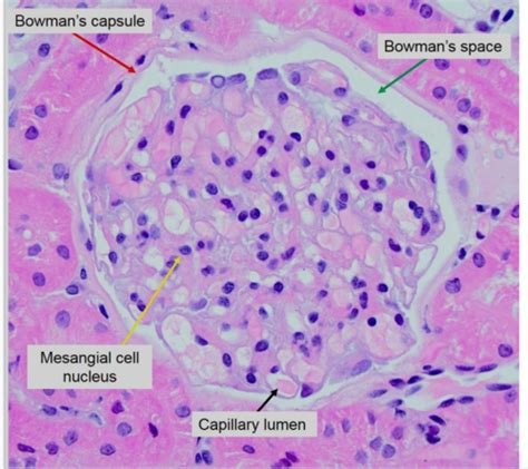 Urinary 5 Histopathology Flashcards Quizlet