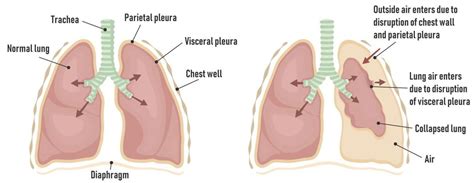 Biomed Pathophysiology Wattpad 43 Off