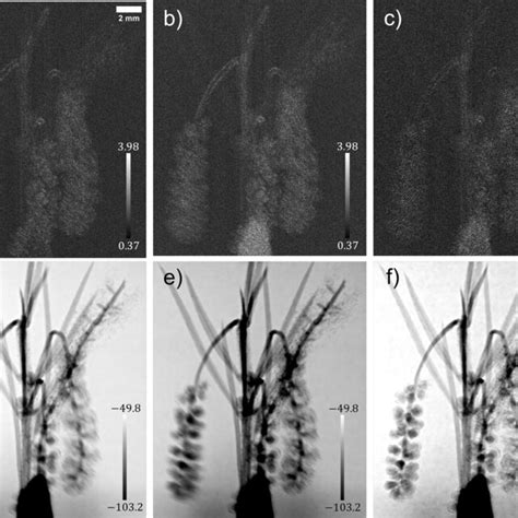 Experimental Setup Of Speckle Based Phase Contrast X Ray Imaging Using
