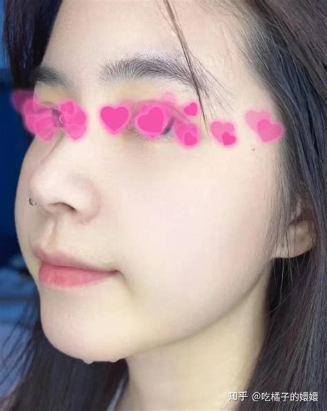 求问敏感肌该怎么有效祛痘修复？有什么水杨酸和面膜推荐吗？ 知乎