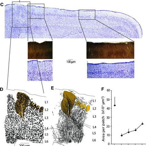 Identified Neurons From The Deep Layers Of Medial Entorhinal Cortex A