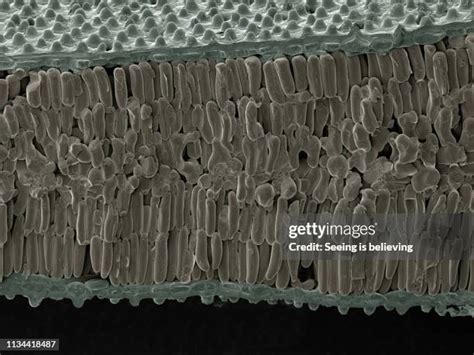 Environmental Scanning Electron Micrograph Photos And Premium High Res