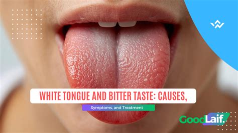 White Tongue And Bitter Taste Causes Symptoms And Treatment Reach