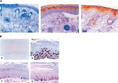 Expression Of Enhancing Factorphospholipase A2 In Skin Results In Abnormal Epidermis And