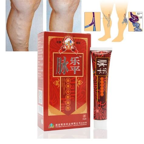 Creme Para Tratamento Varizes Vasinhos Varicose Veins Pomada Mercado Livre
