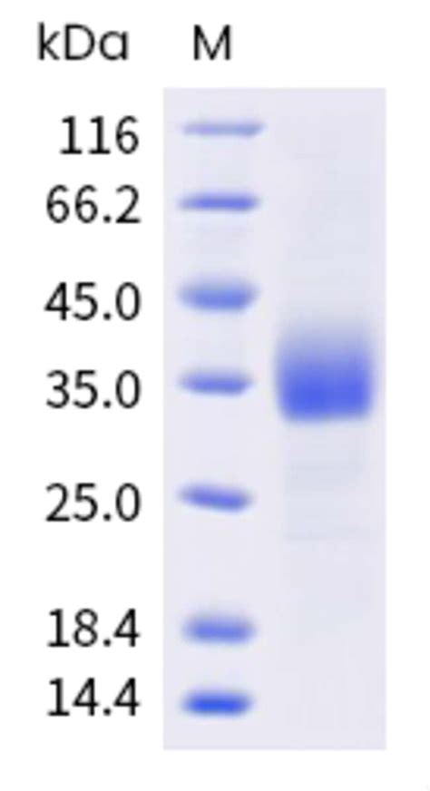 Sino Biological Human Cd72 Protein 100ug Sino Biological Quantity