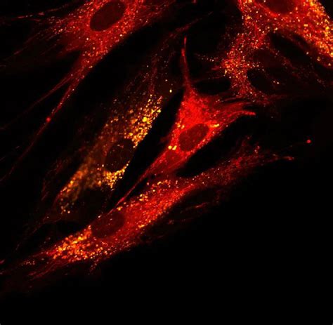 细胞骨架 微丝与细胞运动 蛋白 组装 核反应