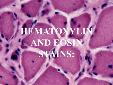 Hematoxylin And Eosin Stains Ppt
