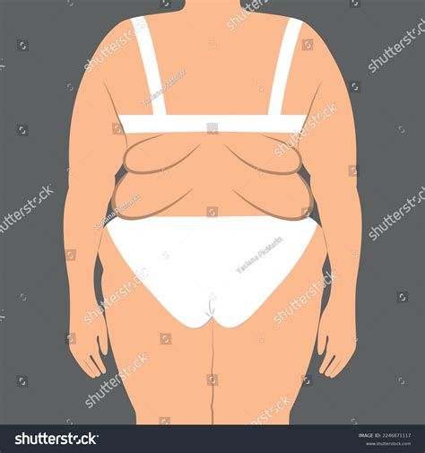 Obese Overweight Female Body Back View Stock Vector Royalty Free