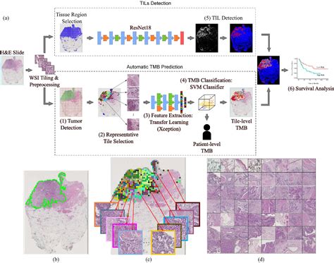 Figure 1 From Spatial Heterogeneity And Organization Of Tumor Mutation Burden With Immune