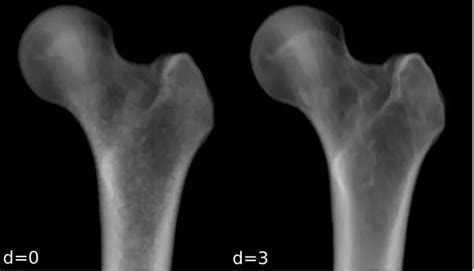 Fast And Accurate Drrs For X Ray Based Joint Surgery Planning Hans Lamecker