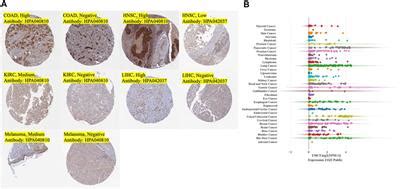Frontiers TMC5 Is Highly Expressed In Human Cancers And Corelates To