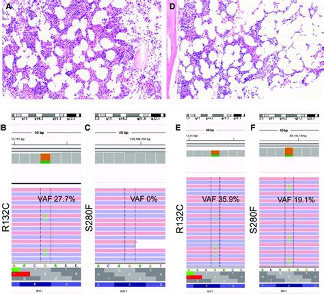 Representative Morphologic Immunophenotyping And Idh1 Mutation Data Download Scientific