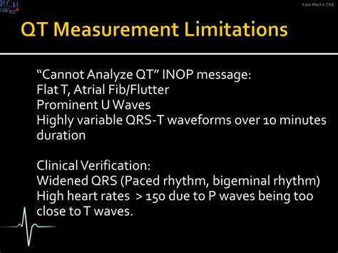 ppt beyond arrhythmias st and qt segment monitoring powerpoint