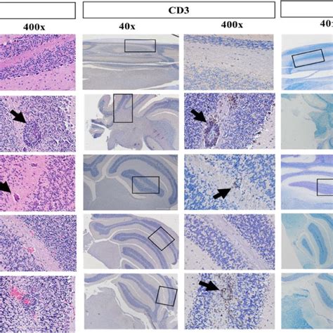Immunohistochemical Examination Of The Mice Brains A Brains Of Normal