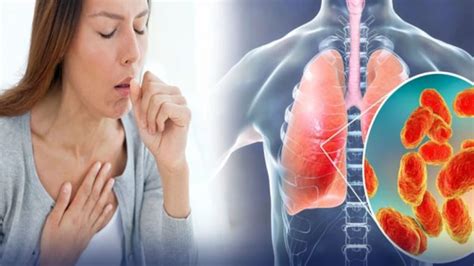 Punjab Govt To Test Drugs For Sinus Infection Influenza And Pneumonia