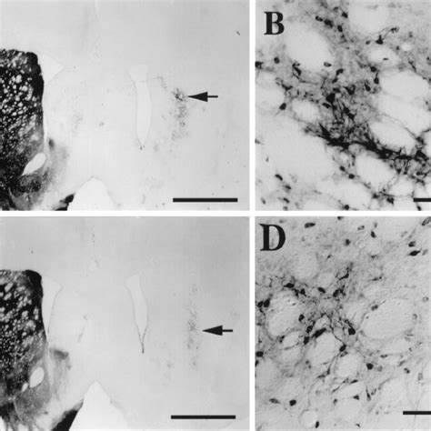 Th Staining Of Raav Infected Striatum 6 Months After Vector Injection