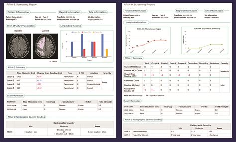 Alzheimer Disease Imaging In The Era Of Anti Amyloid Treatment
