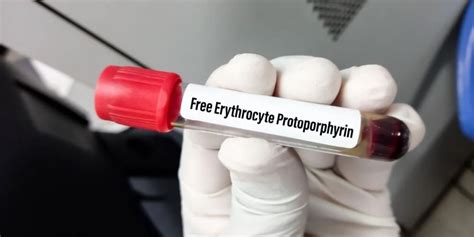 Protoporfirina Libera Eritrocitara Ce Este Si Ce Trebuie Sa Stii