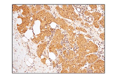 Pdgf Receptor Activation Antibody Sampler Kit Cell Signaling Technology