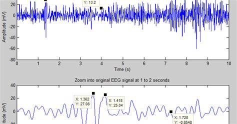 Biomedical Signal And Image Processing Projects Using Matlab And Labview Tools Matlab Code To
