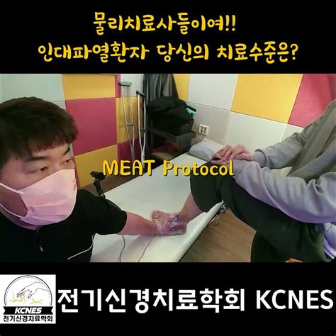 물리치료사들이여 인대파열 환자를 치료첫날 바로 움직일수 있게 할수 있는가 가능하면 경쟁력 갑 전기신경치료 인대파열치료 염좌치료 Youtube