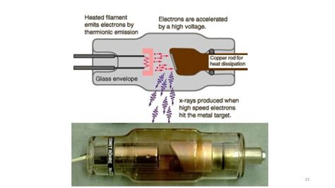 X Ray Tube Anode
