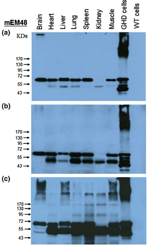 Expression Of Mutant Htt In Different Tissues At Different Stages