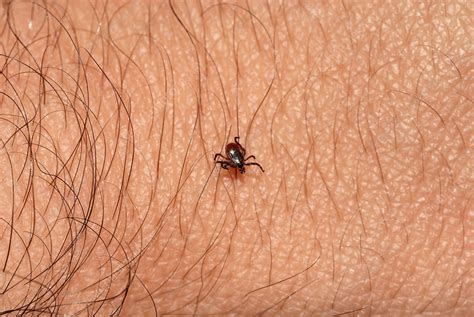 What Does A Buried Tick Look Like At Margret Rodriguez Blog