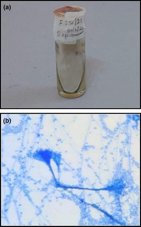 Ab Colony Morphology And Lpcb Tease Mount Preparation Magnification