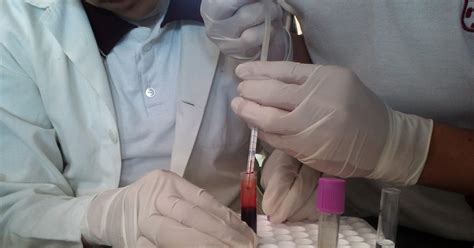 Stephany Renaud Practica No CUENTA DE ERITROCITOS