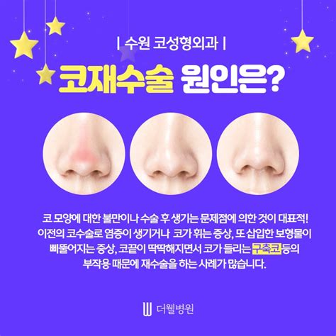 수원 코성형외과 코재수술 꿀팁 건강정보 수원 더웰병원