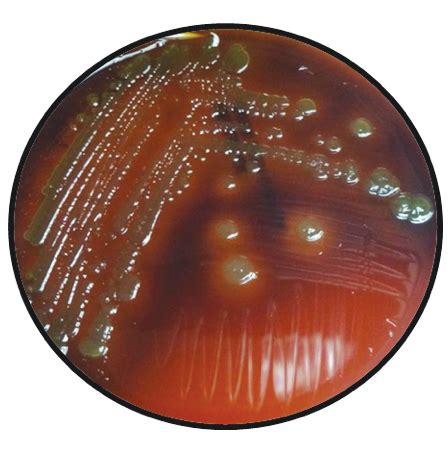 Vibrio Harveyi A Significant Pathogen Of Maricultured Species
