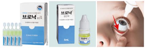 결막염 백내장 수술 후 브로낙점안액 효능 사용법 부작용 가격 정보