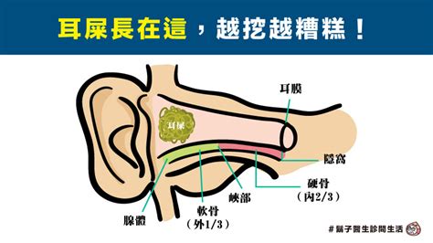 耳屎長在這，越挖越糟糕！｜親子天下