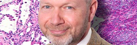 World Leading Ewing Sarcoma Clinical Trial Receives Extra Funding