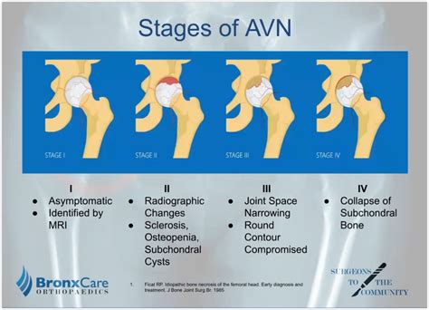 Avascular Necrosis Leading To Total Hip Arthroplasty An Incidence And