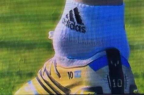 Messis Swollen Ankle Causes A Scare In Argentina Rargentina