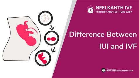 Difference Between IUI and IVF