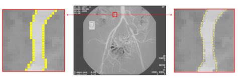 Edge Detection Wikipedia