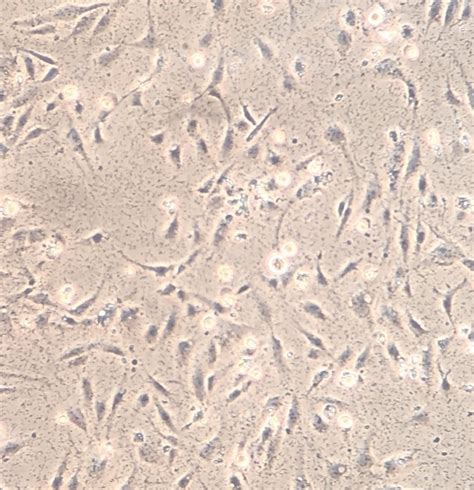 Bacterial Contamination Cell Culture At Rebecca Skinner Blog