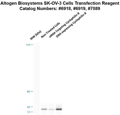 Sk Ov 3 Transfection Kit Human Ovarian Carcinoma Transfection