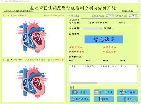基于yolo11深度学习的心脏超声图像间隔壁检测分割与分析系统【python源码pyqt5界面数据集训练代码】深度学习实战、目标分割