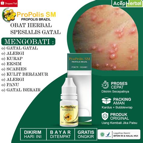 Jual Obat Gatal Gatal Di Badan Eksim Kurap Panu Jamur Psoriasis Scabies