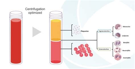 Platelet Rich Plasma Injection For Arthritis Sport Doctor London