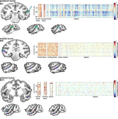Anatomical Correlates Of Face Patches In Macaque Inferotemporal Cortex Pnas