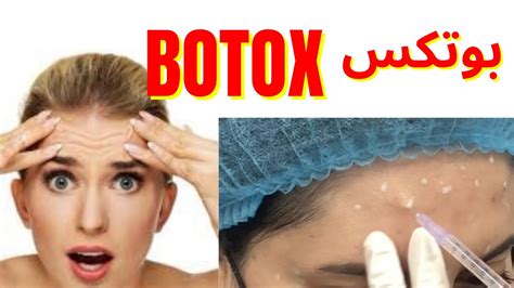 Botox البوتكس نصائح وتحديرات مع الدكتورة سُلاف لأول مرة عاليوتيوب 😳 1m Youtube