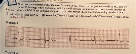 Now That You Understand What The Wave Forms On An ECG Chegg